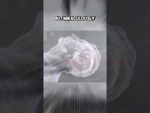 The Man Who Survived a Deadly Particle Beam Accident - Anatoli Bugorski