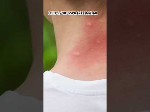 OAK ITCH MITES - How to Control and Treat | https://bugspray.com/oak