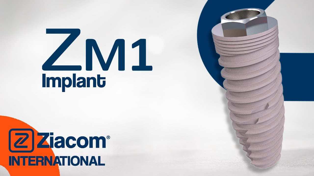 ZM1 - External Connection Implant - Simplicity and Versatility