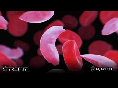 The Stream - Living with sickle cell anemia