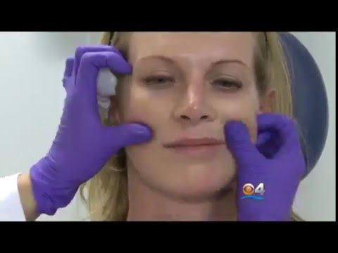 Using the dermal filler Voluma for cheek volume on CBS Miami