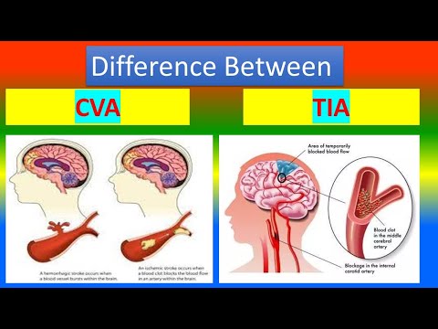 Difference between CVA and TIA