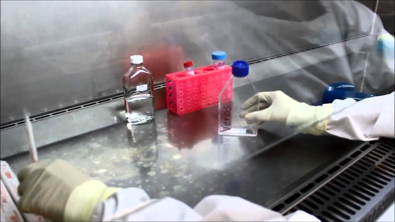 Trypsinising a flask of vero cells