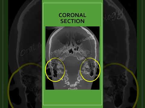 INTERPRETATION OF CBCT - Identify the Structure