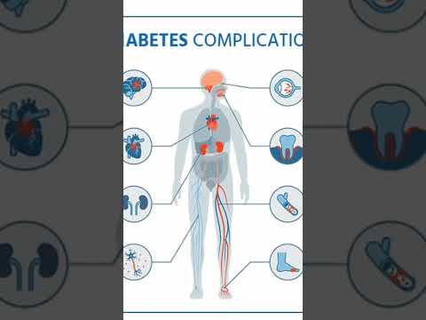diabetes mellitus,#blood glucose chart,#diabetes complications,# control diabetes