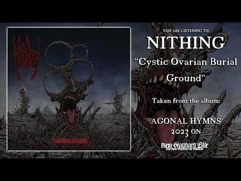 Nithing music, videos, stats, and photos | Last.fm