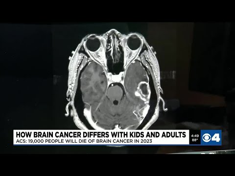 Dr. Perkins joins News 4 to discuss brain cancer risks and treatments