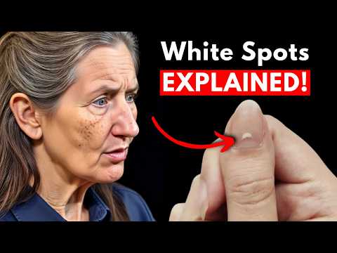 White Spots on Your Nails Here’s What Your Body is Telling You | Barbara O’Neill