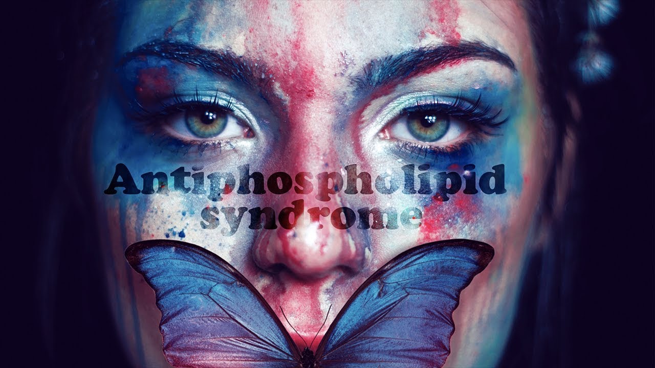 Antiphospholipid syndrome: clinical features, diagnosis and management