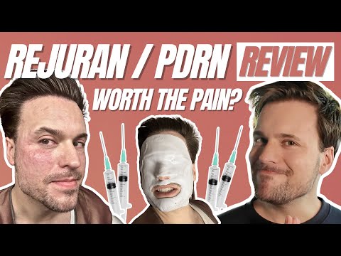 Rejuran Review: Are PDRN Injections Worth the Money and Pain?