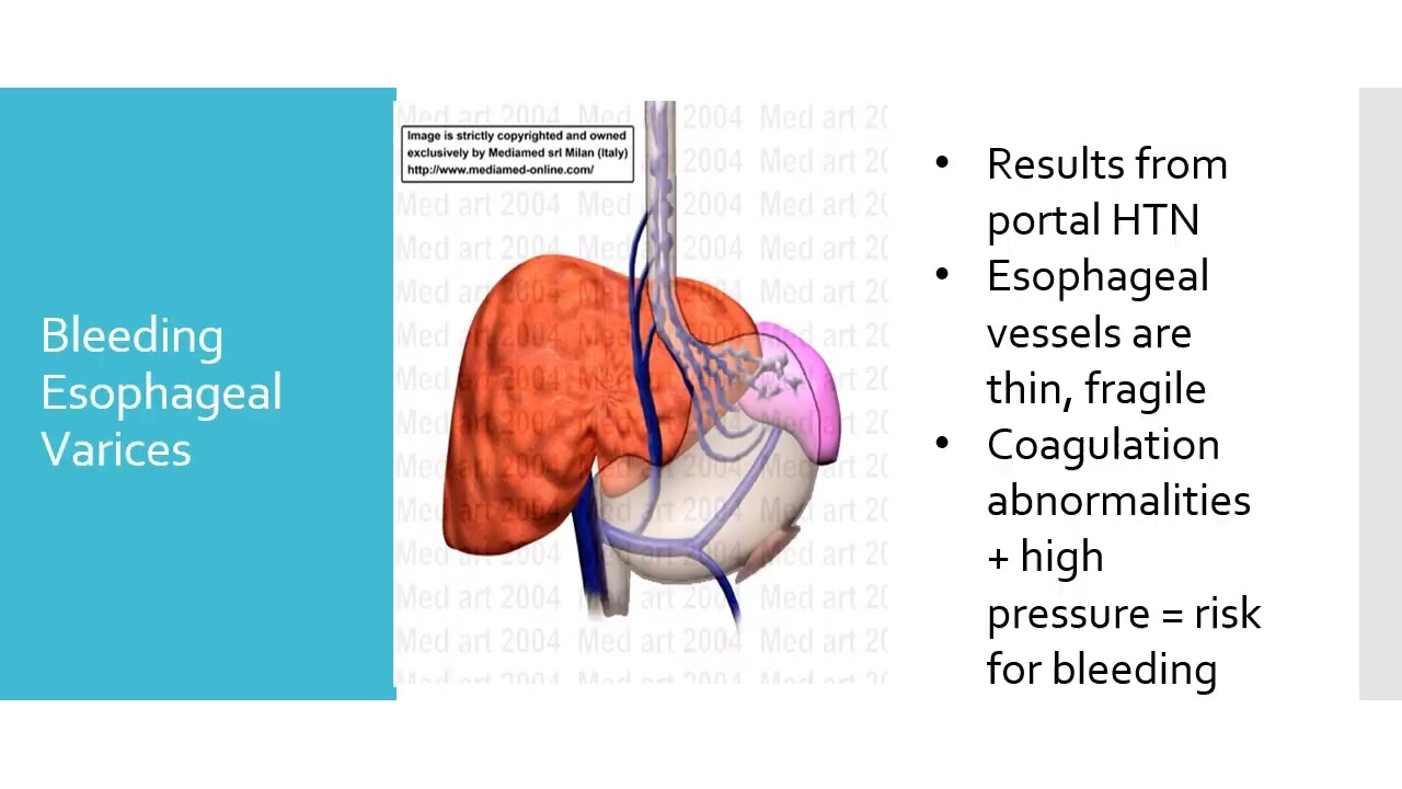 GI PowerPoint