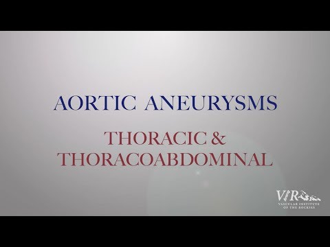 Aortic Aneurysms- Thoracic & Thoracoabdominal