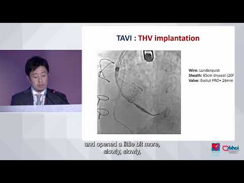 Distinguished Real-time AI Technology to Support Complex Catheter Interventions