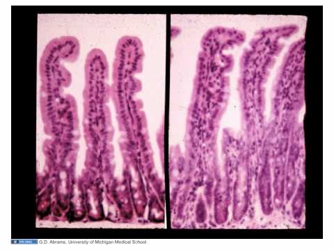 The Digestive Tract Ecosystem
