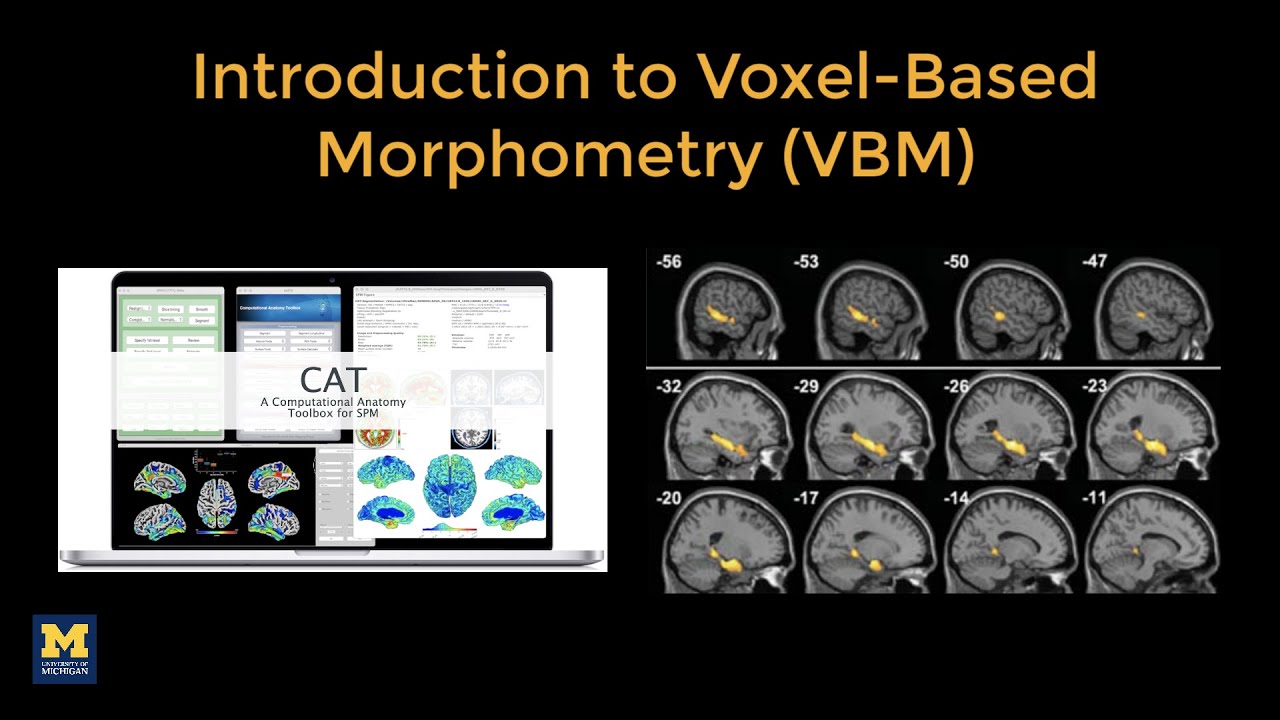 CAT12 Tutorial #1: Download and Install
