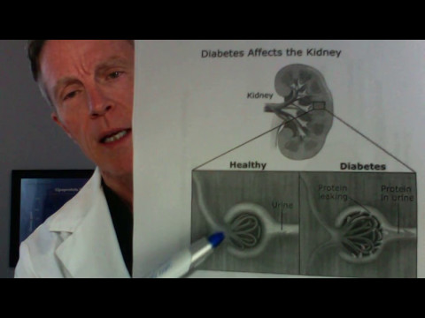 How to Test for Cardiovascular Inflammation: Microalbumin Creatinine Ratio
