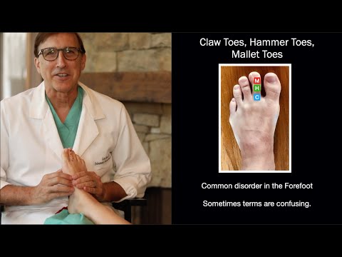 Claw Toe, Hammer Toe, Mallet Toe