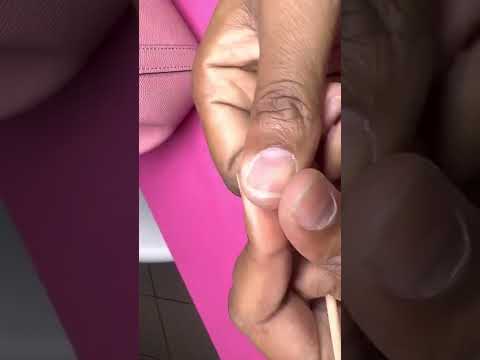 Eponychium vs. Cuticle 😱 PLEASE DONT DO THIS‼️