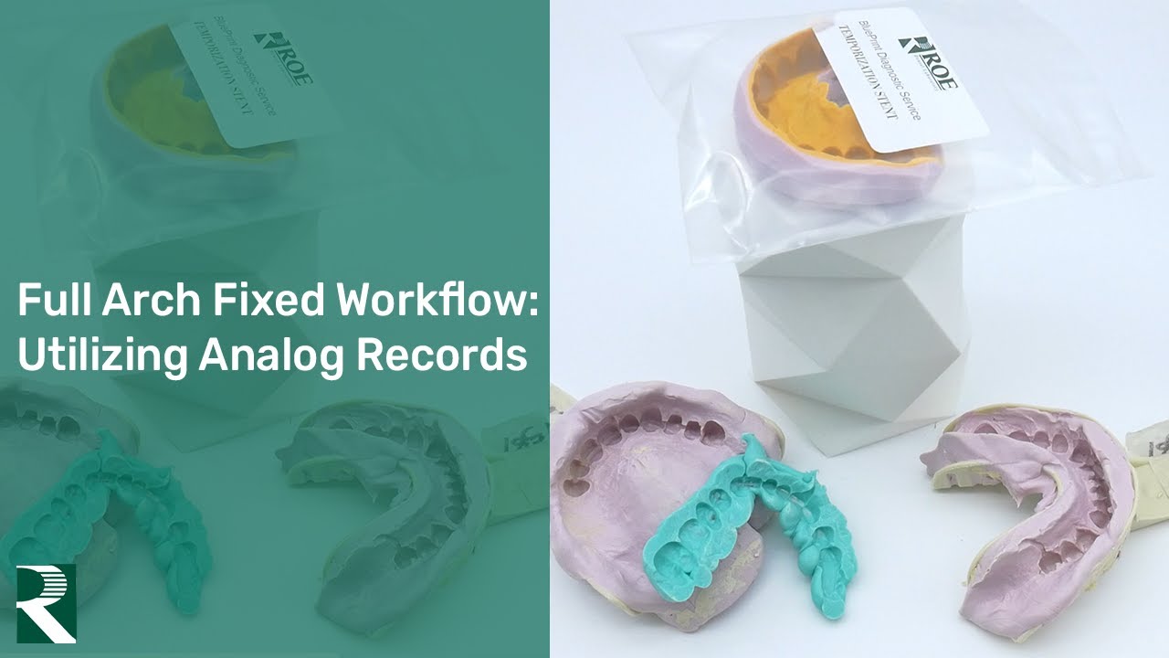 Full Arch Fixed Workflow: Utilizing Analog Records