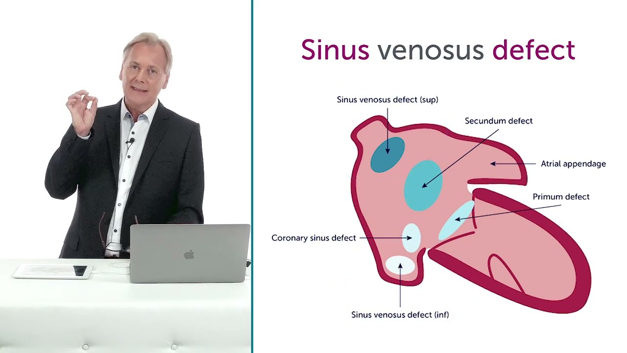 What is a sinus venosus defect?