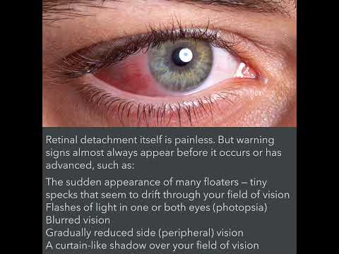 HEAL YOURE RETINA WITH HOMEOPATHY