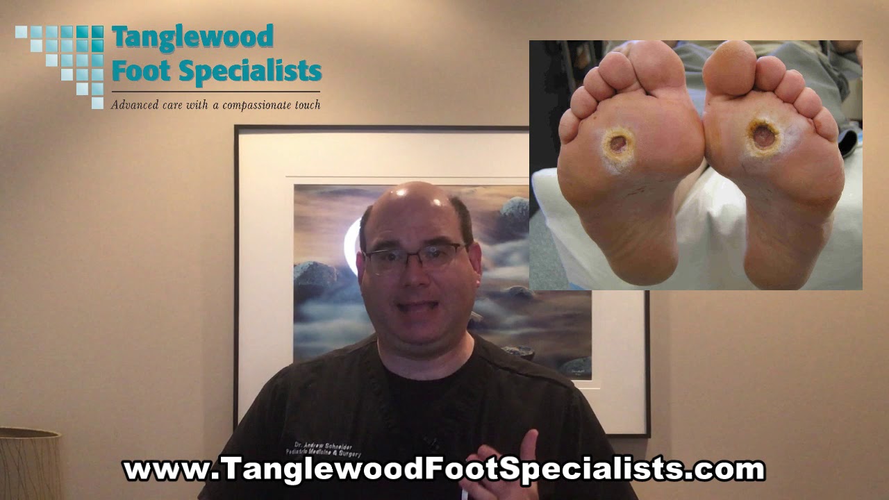 Diabetic Foot Inspection to Prevent Foot Ulcers