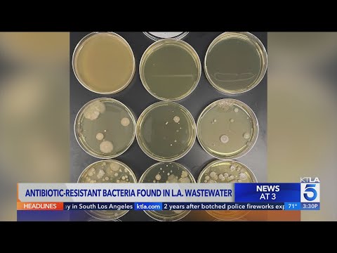 Antibiotic-resistant super bacteria found for the first time in Los Angeles County