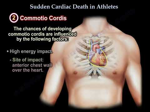 Sudden Cardiac Death in Athletes – Dr. Nabil Ebraheim's Blog