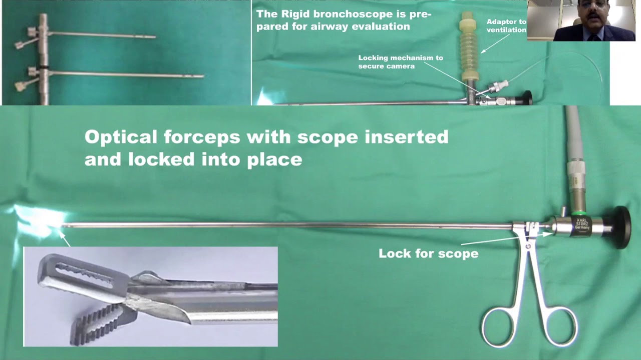 Removal of foreign body from a child's airway: Flexible & Rigid Bronchoscopy I Dr Ankit Parakh
