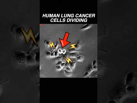 Human lung cancer cells dividing RAPIDLY! #microscope #cancer #biology #oncology #medical #science