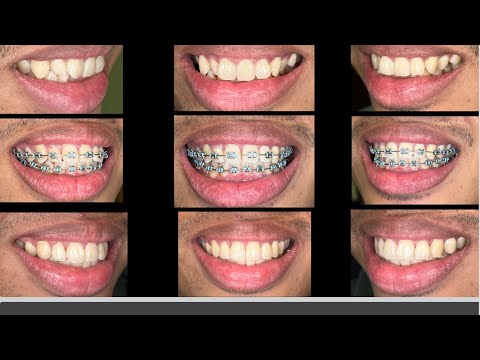 Meet Dr. William Hang, DDS and Dr. Brian Hockel