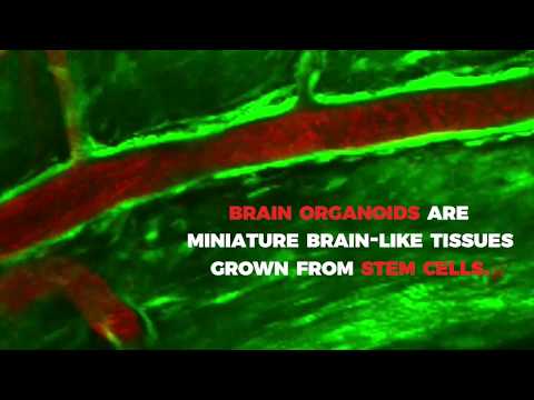 Brain Organoids As Models for Neurological Disorders