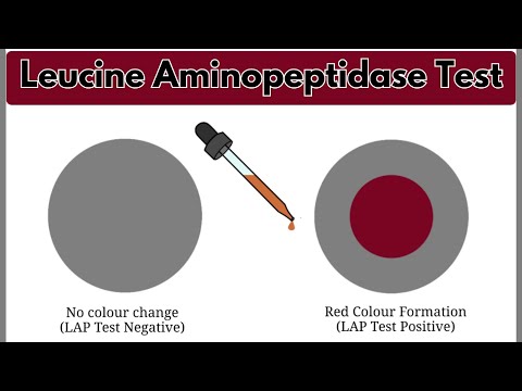 Leucine Aminopeptidase Test (LAP Test) | Biochemical Test | Microbiology Laboratory Practical
