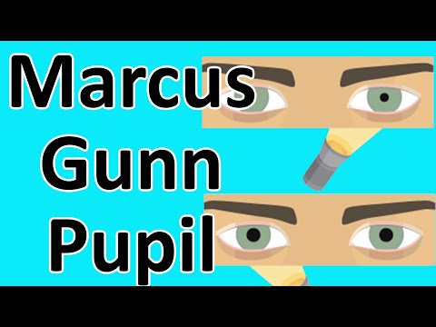 Marcus Gunn Pupil
