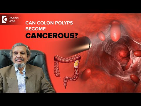 Colon Polyps - Risk of turning into Cancer & Its Best Treatment -Dr. Rajasekhar M R| Doctors' Circle