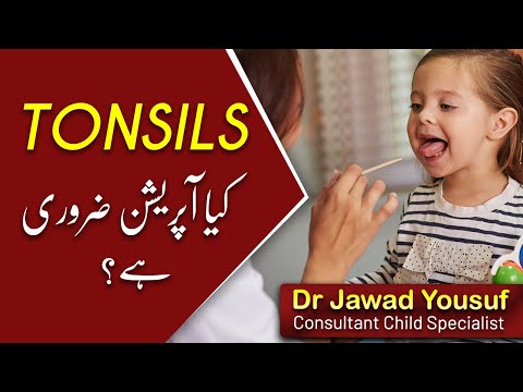 Tonsils || Urdu | Hindi || Healers Online
