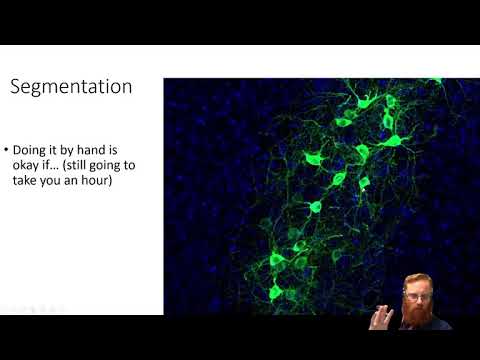 Calcium Imaging 5 - Actual imaging