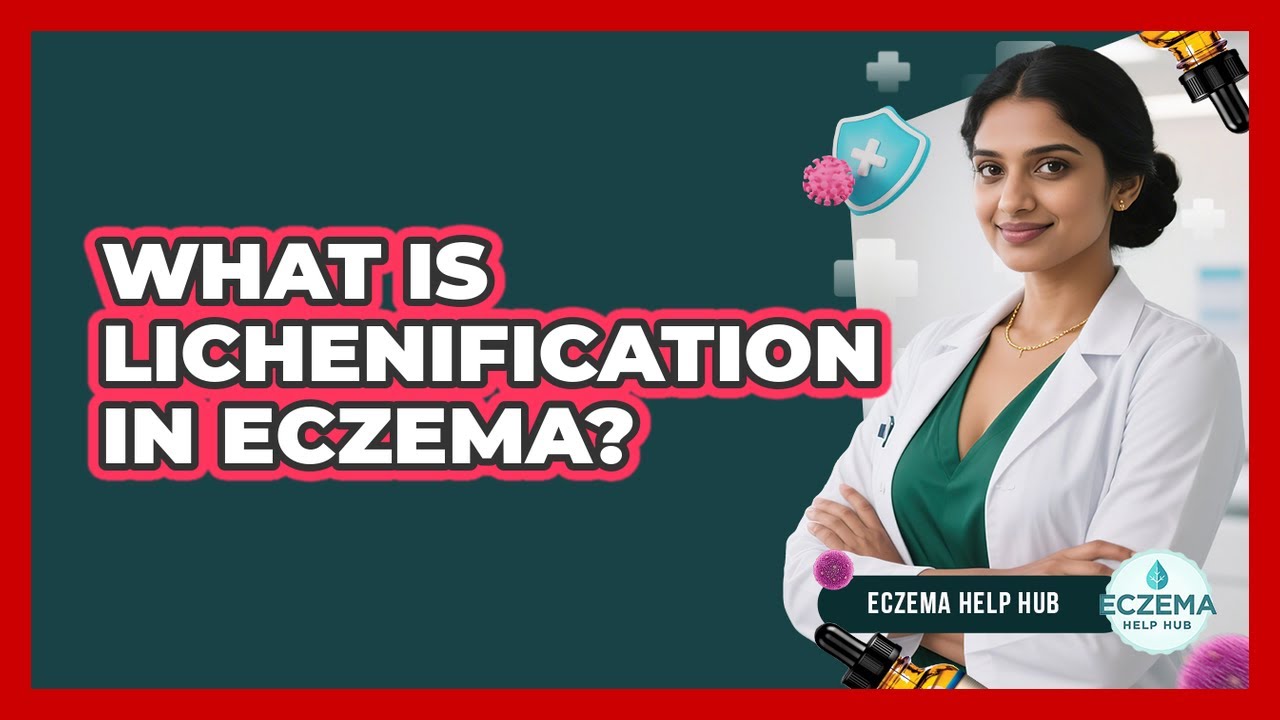 What Is Lichenification In Eczema?
