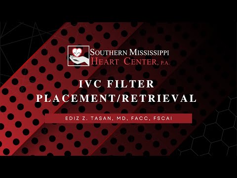 IVC Filter Placement: Retrieval at Southern Mississippi Heart Center