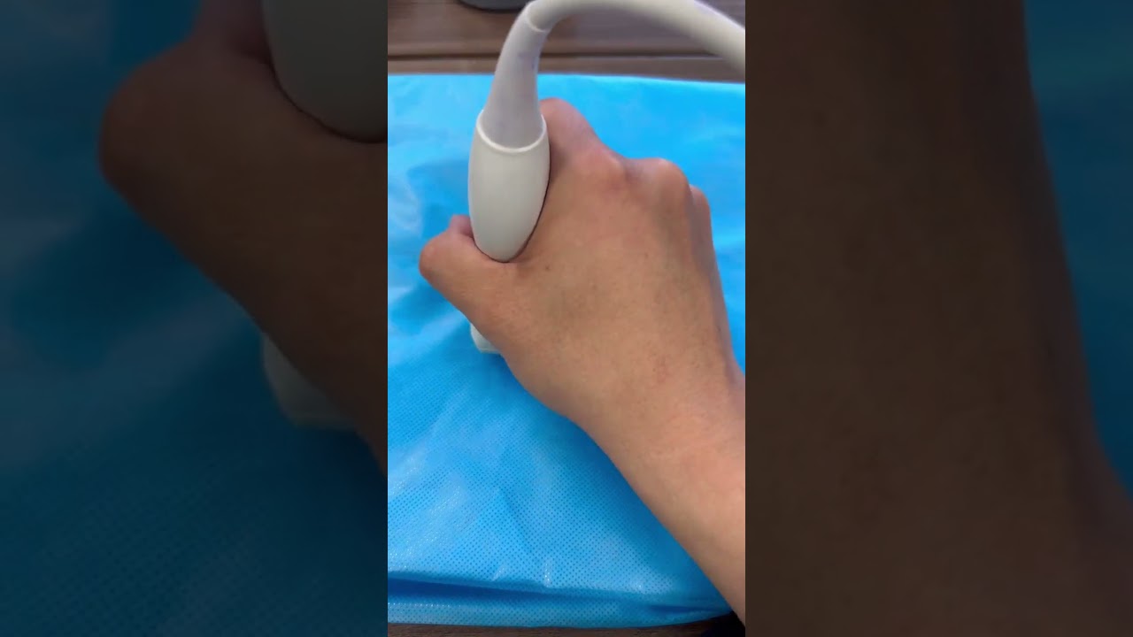 Ultrasound basic maneuvers