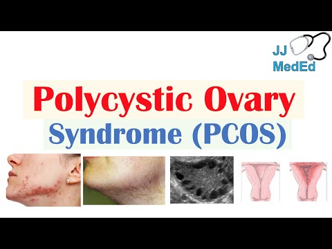 Polycystic Ovary Syndrome (PCOS) - Causes, Risks and Treatments