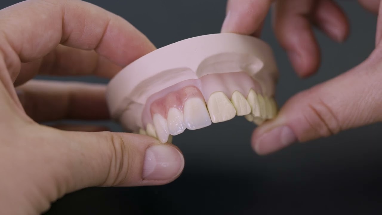 IPS e.max Ceram Art tutorial – Chapter 1 - Product introduction ivoclar | EN