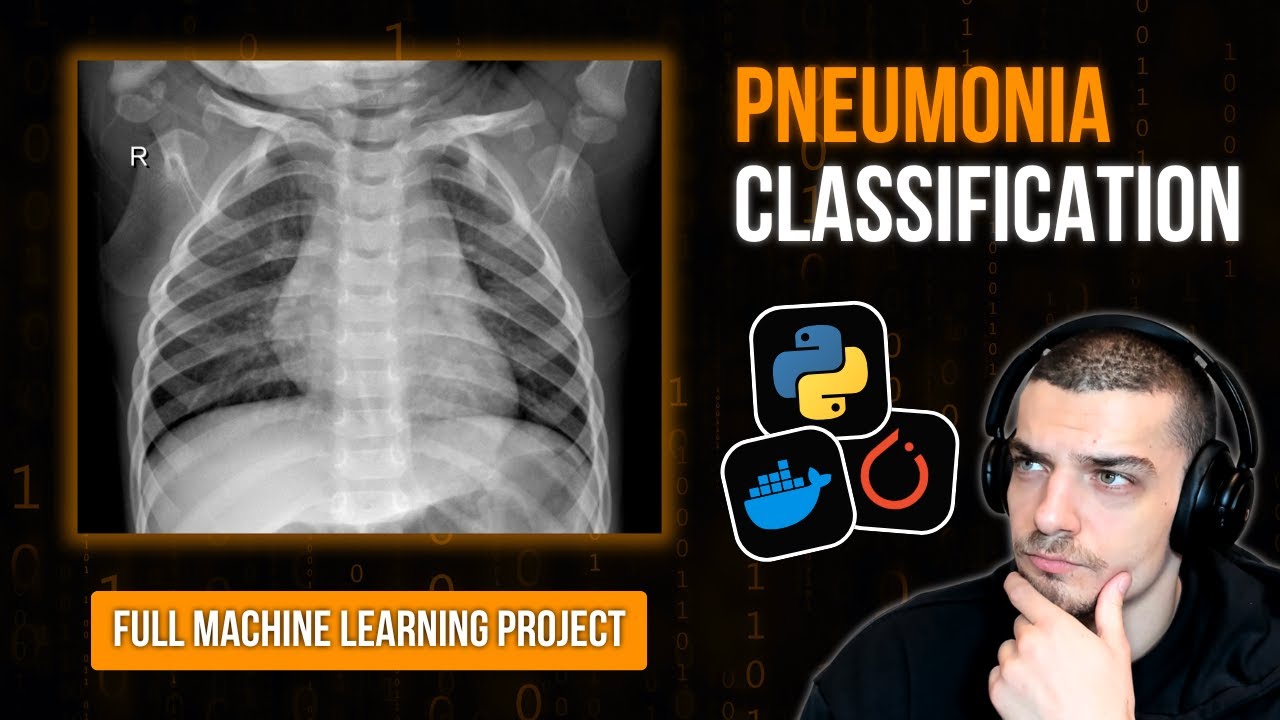 Building a Pneumonia Classifier: A Comprehensive Guide to Training and ...