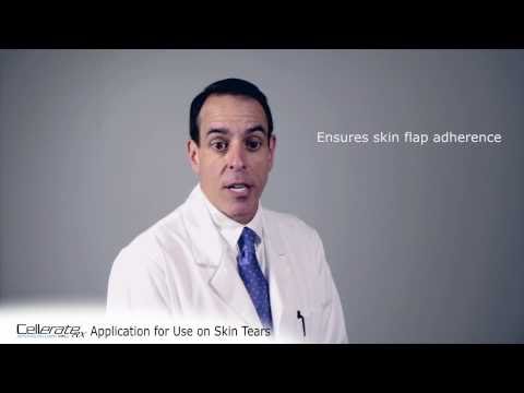 CellerateRX Activated Collagen Use on Skin Tears