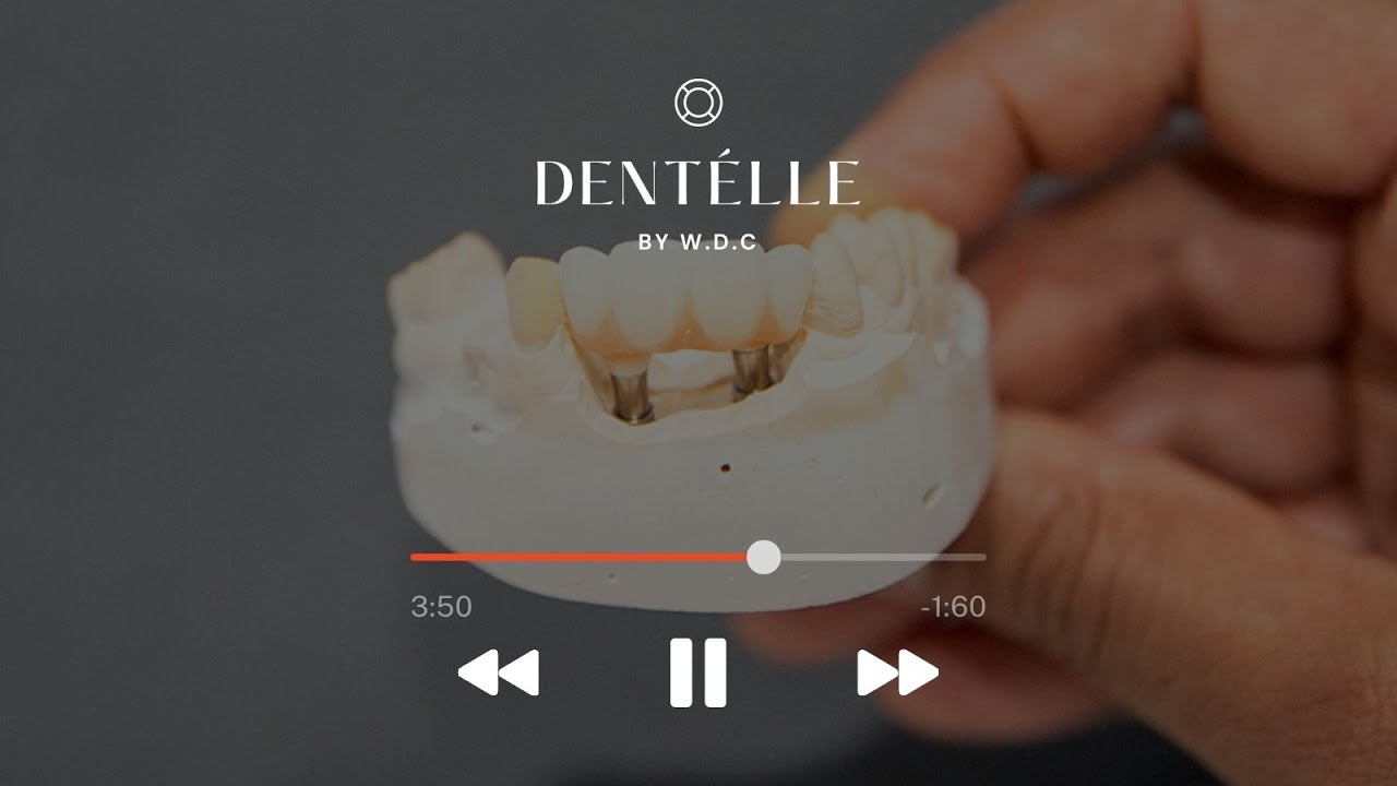 What’s the Best Way to Replace Multiple Missing Teeth?