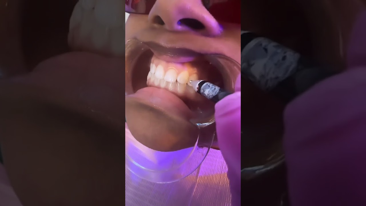 Elevate Your Smile with Swarovski Crystal Tooth Gems #blackownedbusiness