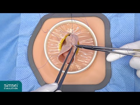 Cholecystectomy and Introduction to Colectomy Curriculum with the Simsei Simulation Program