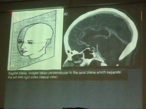 basics of ct and mri dr tougan 1 ent
