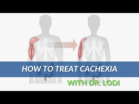 Dr. Lodi: How to Treat Cachexia