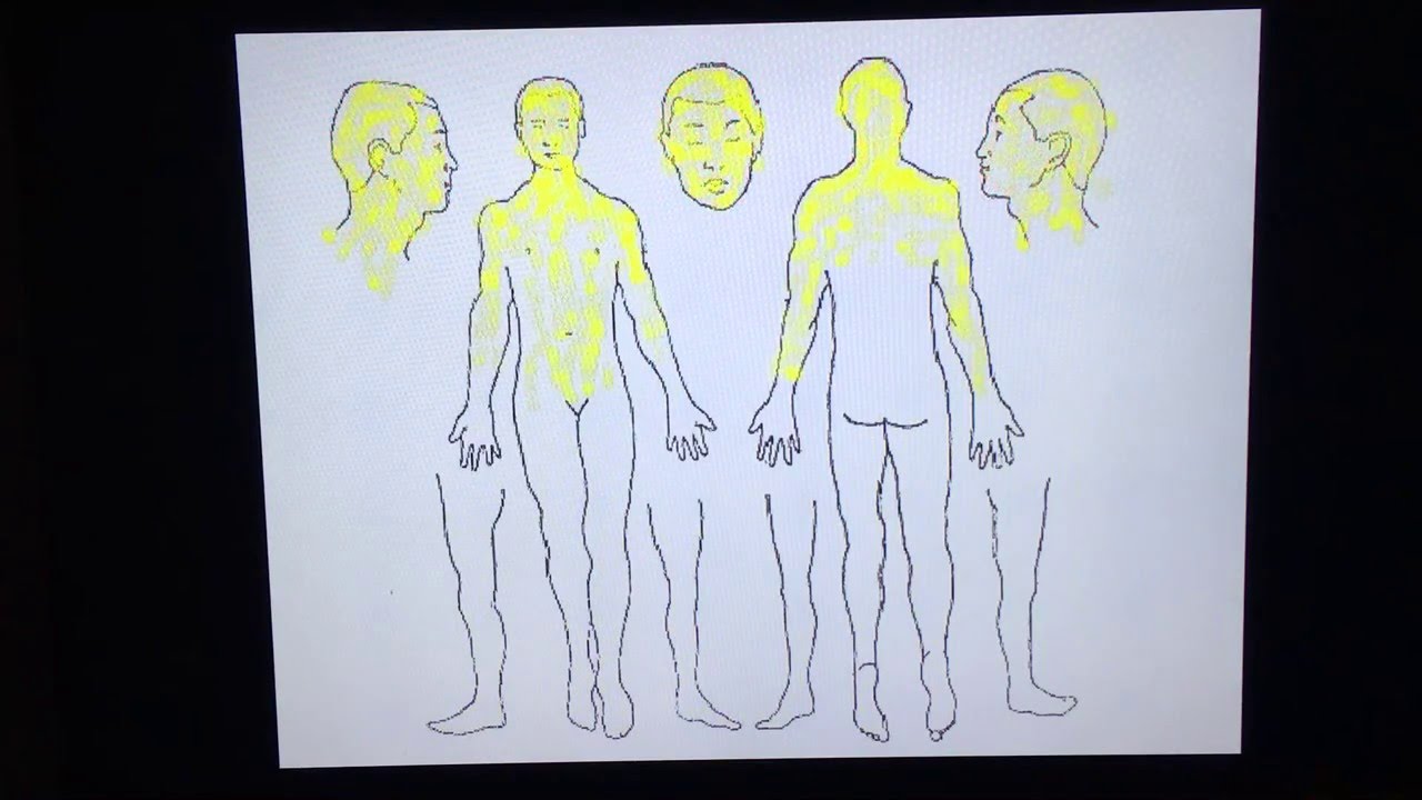 How Does Rolfing Work? -  Rolfing Seminar